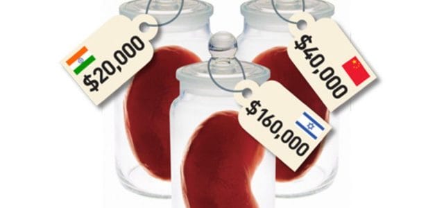 Can You Sell Your Kidney? Archives - Budget and the Bees
